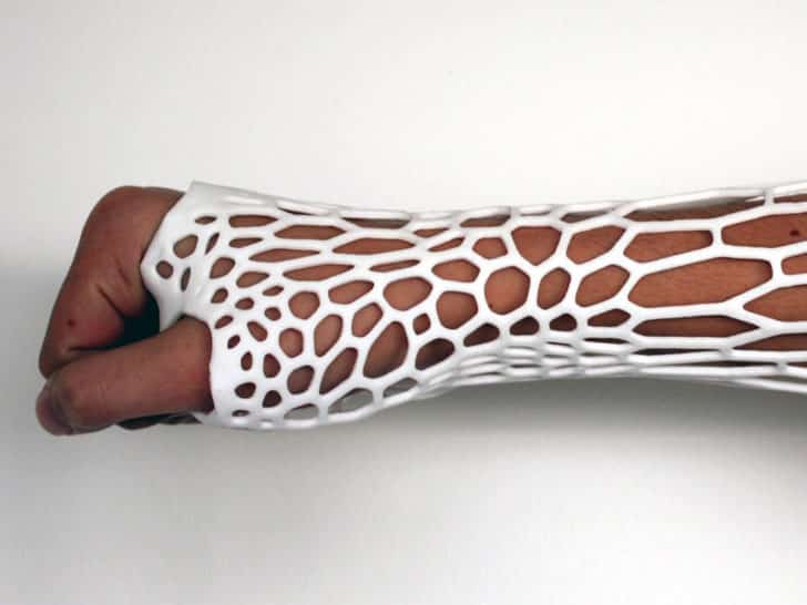 Cortex Cast - 3D Printing to Change How We Fix Broken Bones
